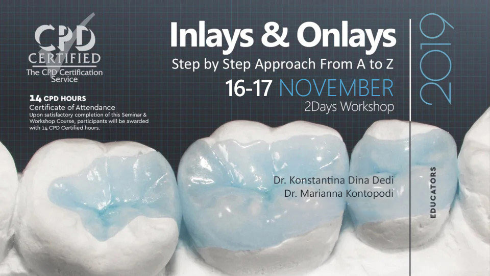 Inlays & Onlays - Step by Step Approach From A to Z • ΙΝΣΤΙΤΟΥΤΟ ΜΕΡΙΜΝΑ