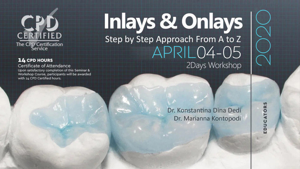 Inlays & Onlays - Step by Step Approach From A to Z • ΙΝΣΤΙΤΟΥΤΟ ΜΕΡΙΜΝΑ