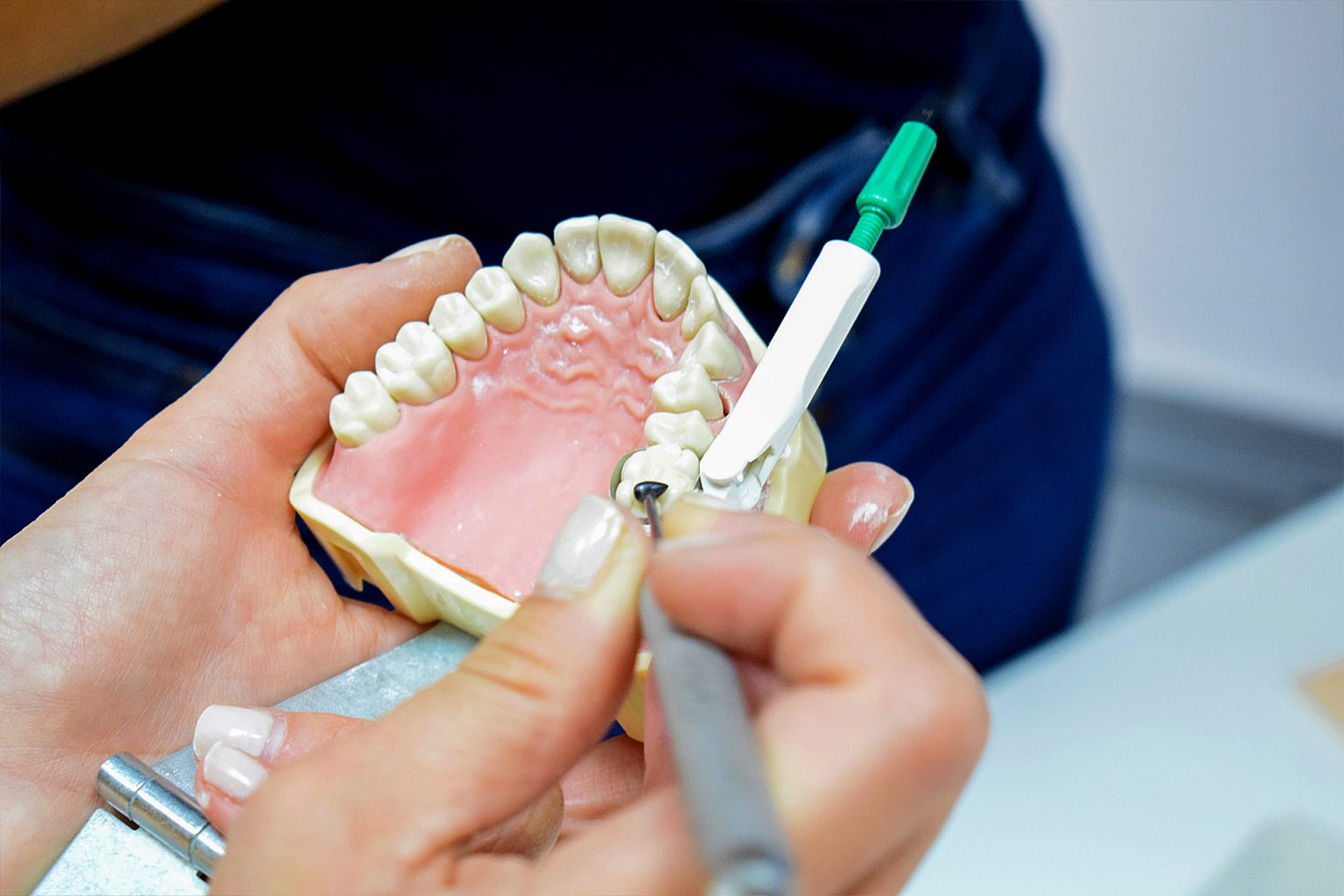 Inlays & Onlays - Step by Step Approach From A to Z - Merimna Institute