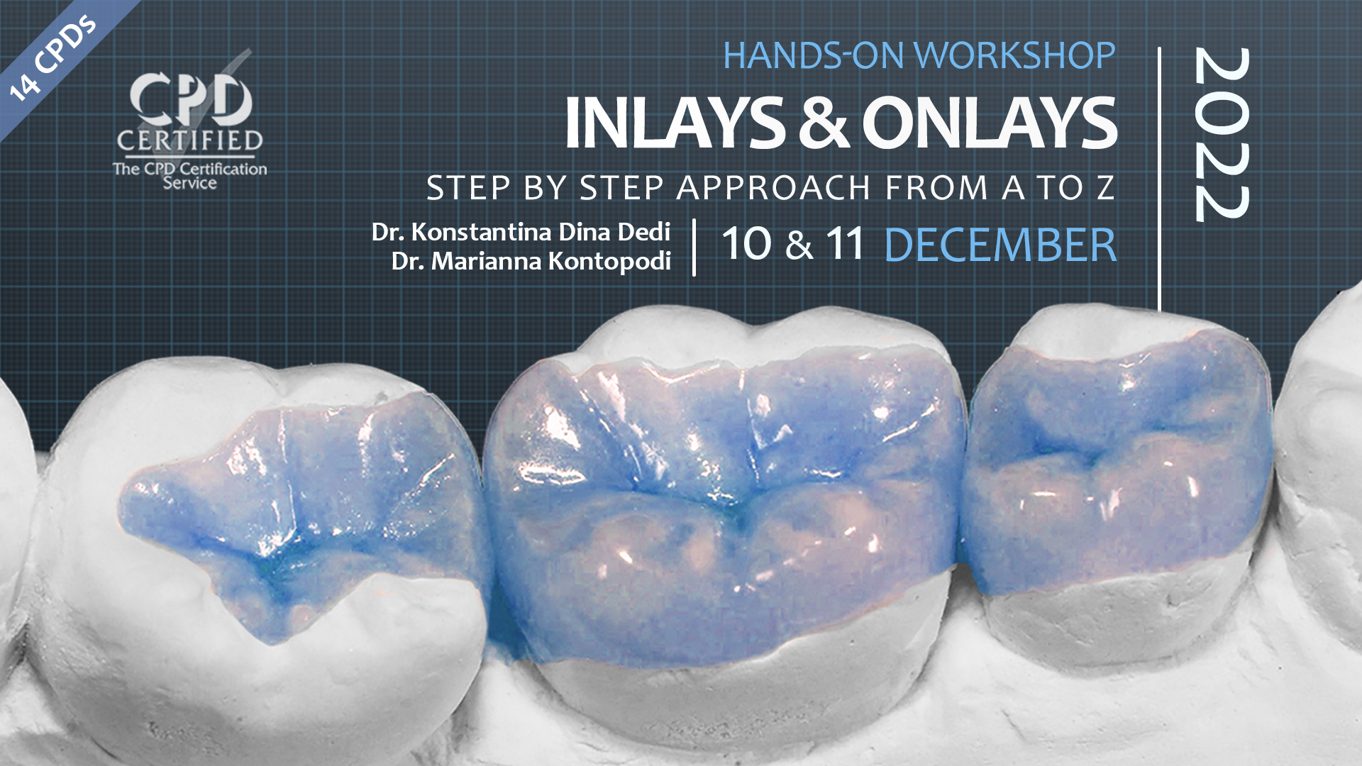 Inlays & Onlays - Step by Step Approach From A to Z • ΙΝΣΤΙΤΟΥΤΟ ΜΕΡΙΜΝΑ