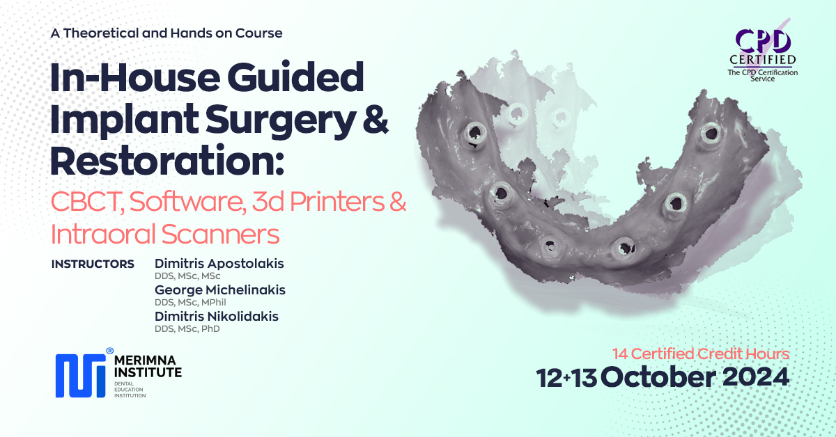 In-House Guided Implant Surgery & Restoration: CBCT, Software, 3d ...