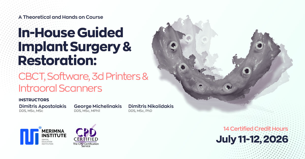 In-House Guided Implant Surgery & Restoration: CBCT, Software, 3d ...